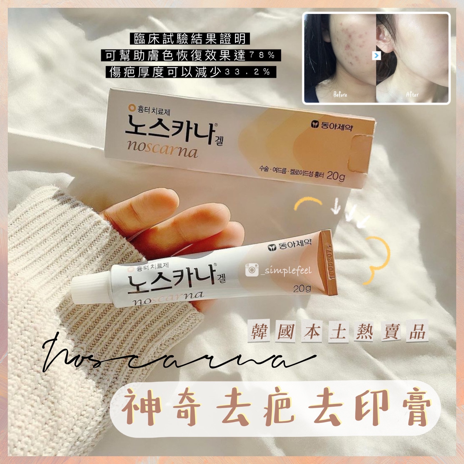 現貨｜韓國本土熱賣品🏥 韓國藥房Noscarna神奇去疤去印膏 Korean Drug Store Nosc