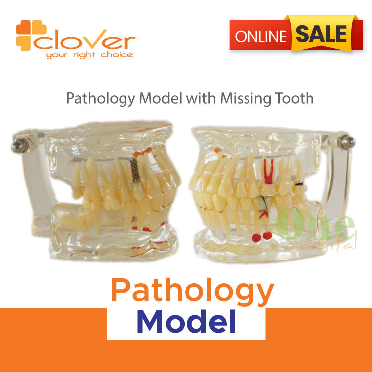 Pathology Model