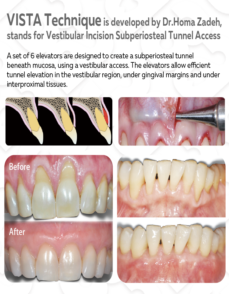 VISTA ABC Developed by Dr. Homa Zadeh