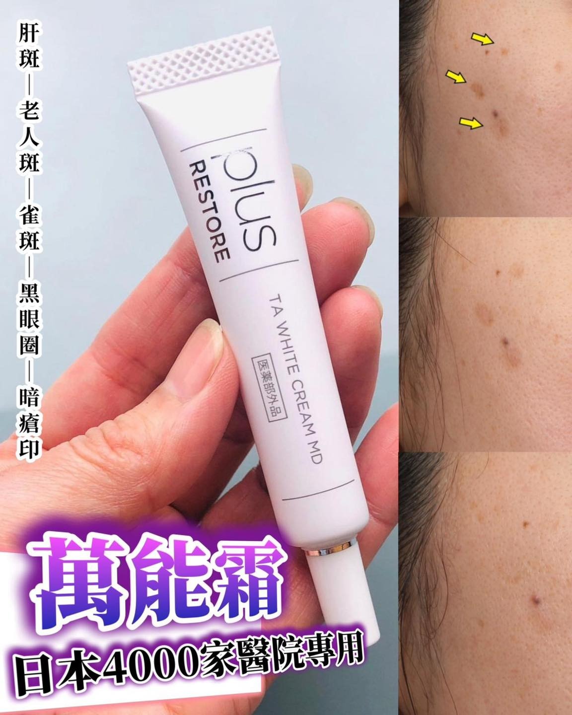 日本Plus Restore TA White Cream MD 美白祛斑祛皺霜 10g