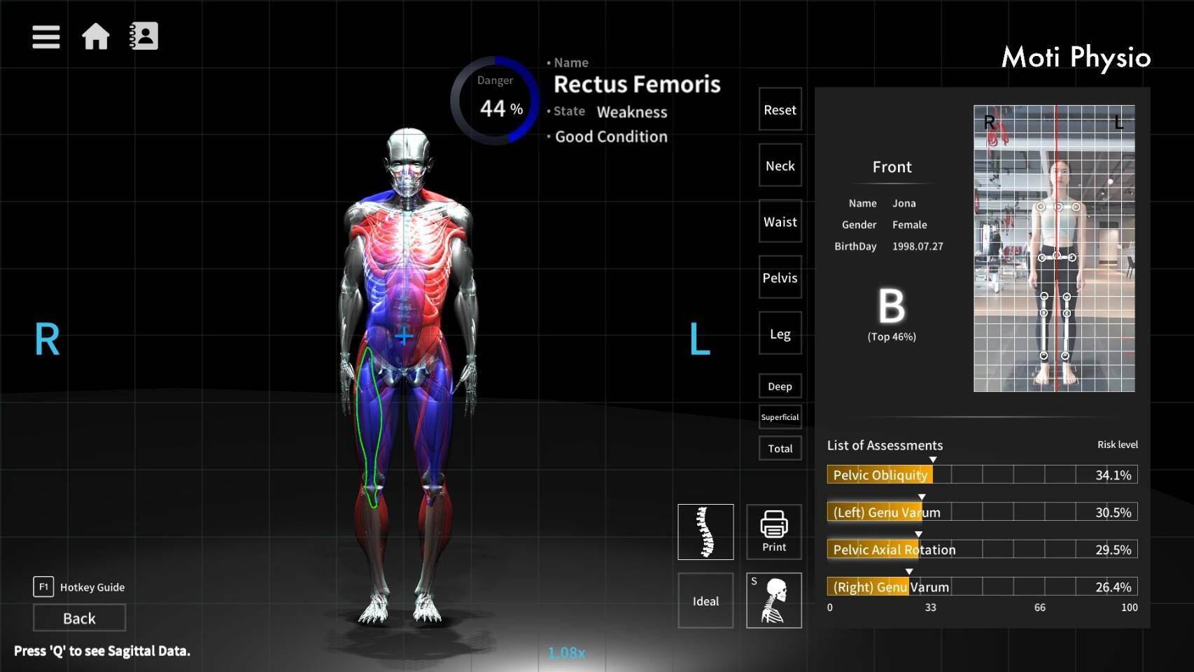 3D身體姿勢分析儀 Moti Physio