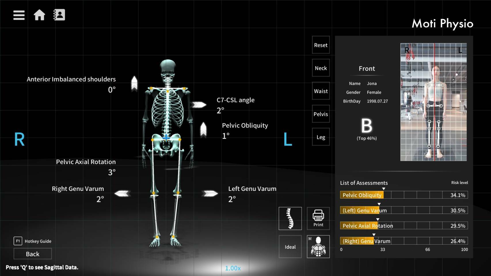 3D身體姿勢分析儀 Moti Physio