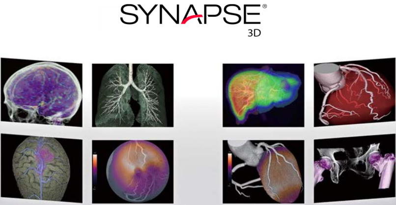 Synapse 3D