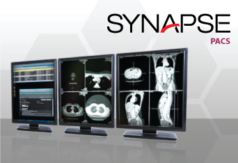 Synapse PACS