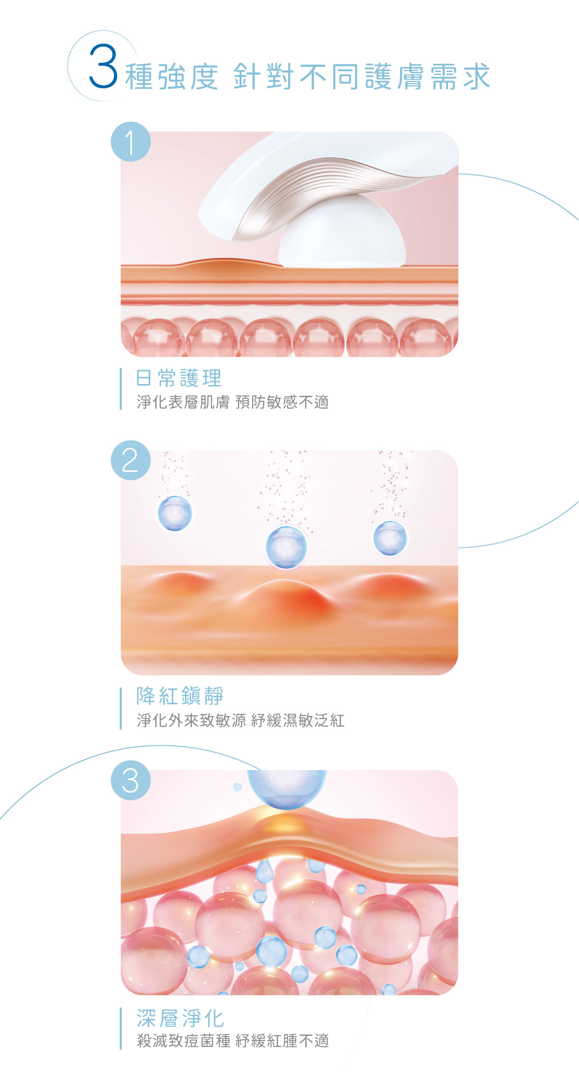 EMAY PLUS Plasma 等離子美顏儀｜全天候吸出粉刺滅痘菌