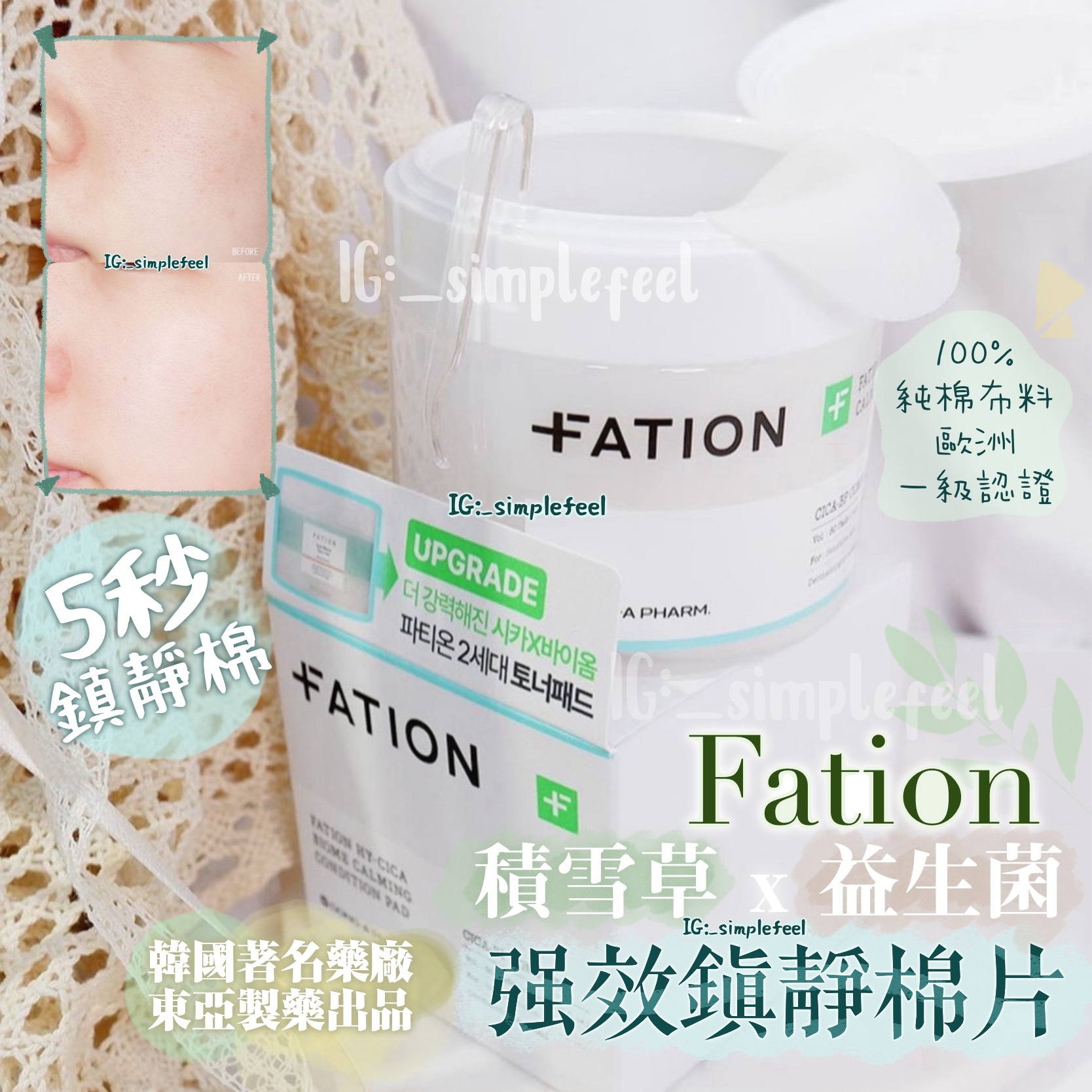 韓國連線折扣｜ Fation去豆無印零瑕疵暗瘡肌棉片