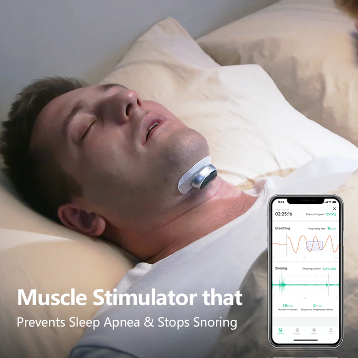 Snore Circle YA4300智能喉部脈衝止鼾器