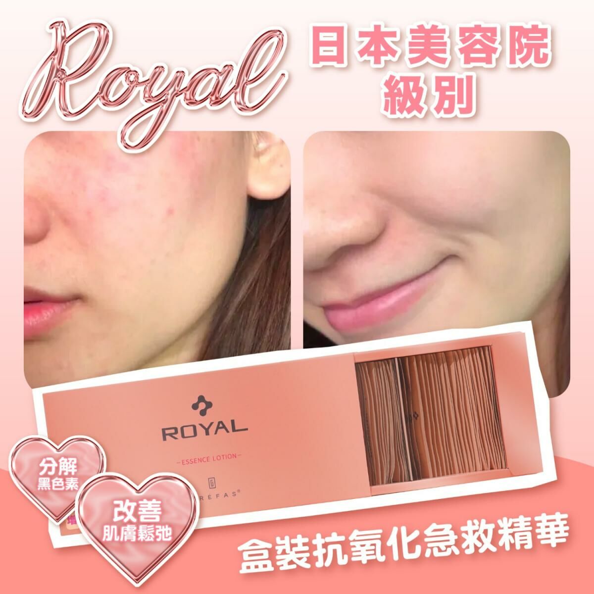 GREFAS Royal 盒裝臍帶血引導精華加強版 90小包(117ml)