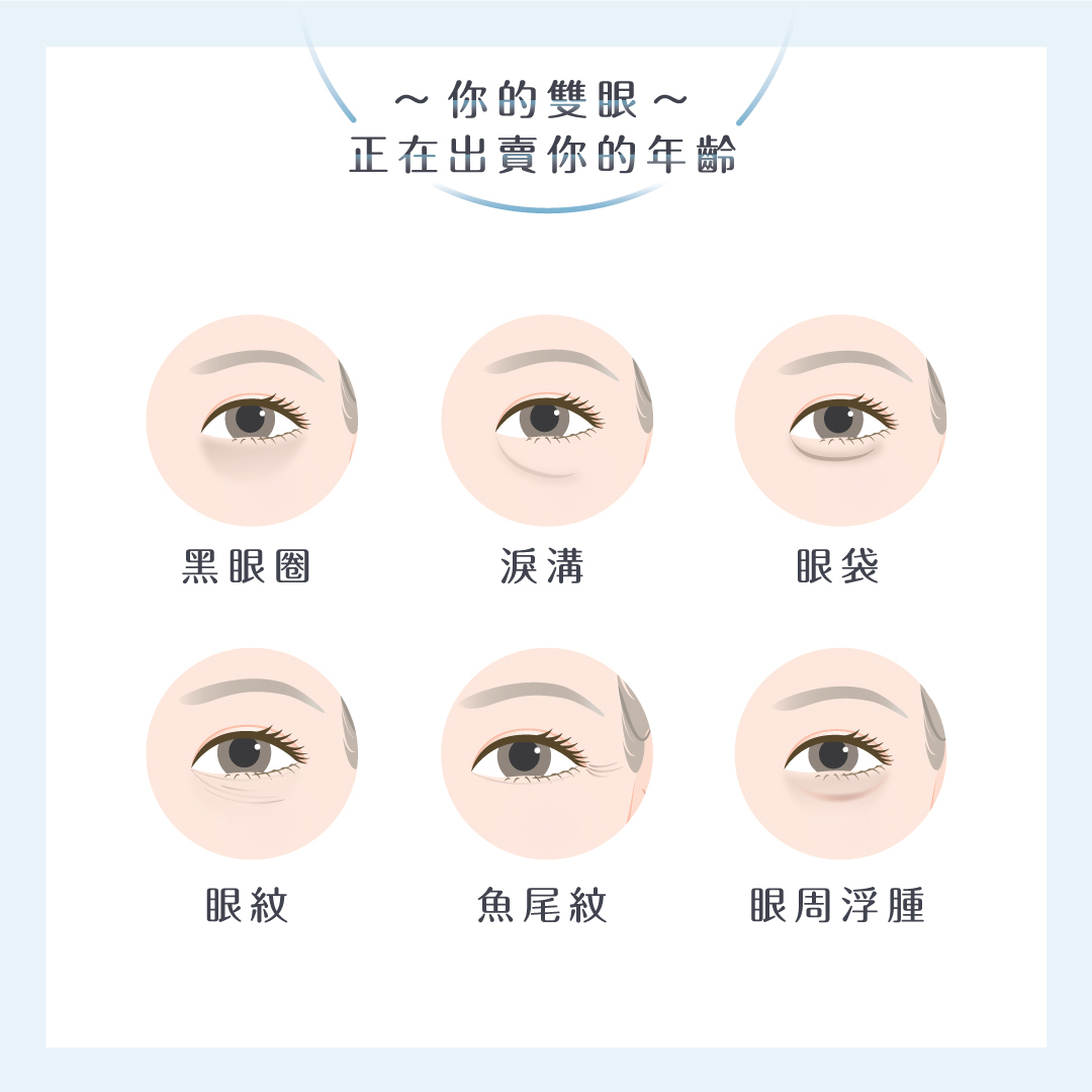 Emay Plus TRIO-Eye Brightener 美眼儀｜RF射頻提拉眼瞼 跳動鬆弛重拾緊緻眼肌