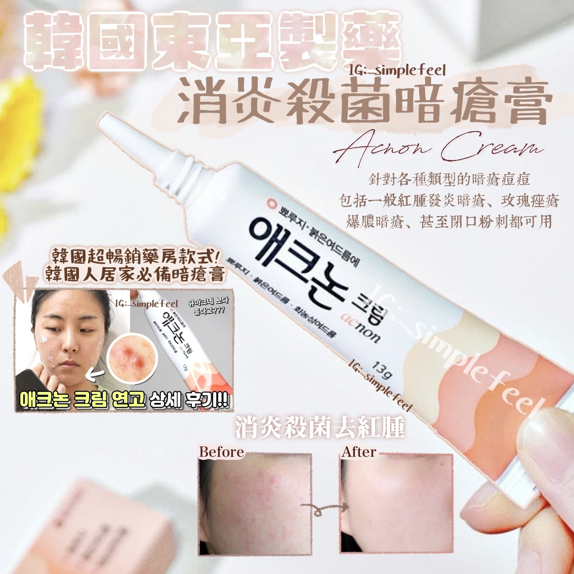 現貨｜韓國藥房款!! 韓國東亞製藥 Acnon 消炎殺菌暗瘡膏 Acnon Cream