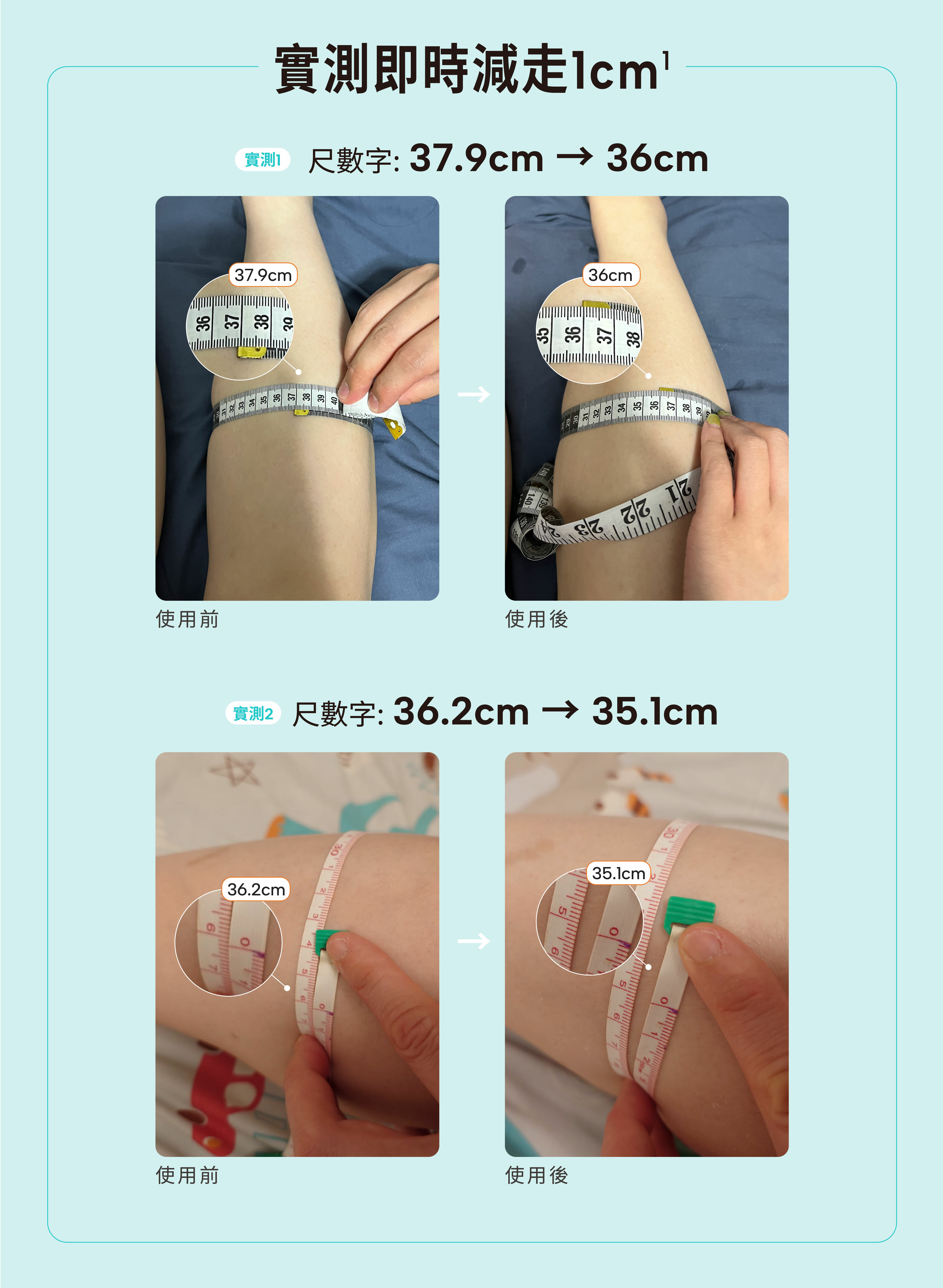 EMAY PLUS 雙用提拉小顏儀 美容水刮｜排走水腫刮走1cm