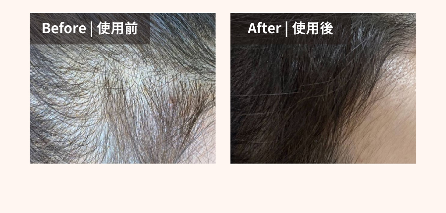 H'ar Dr. Ran 雞蛋洗髮精