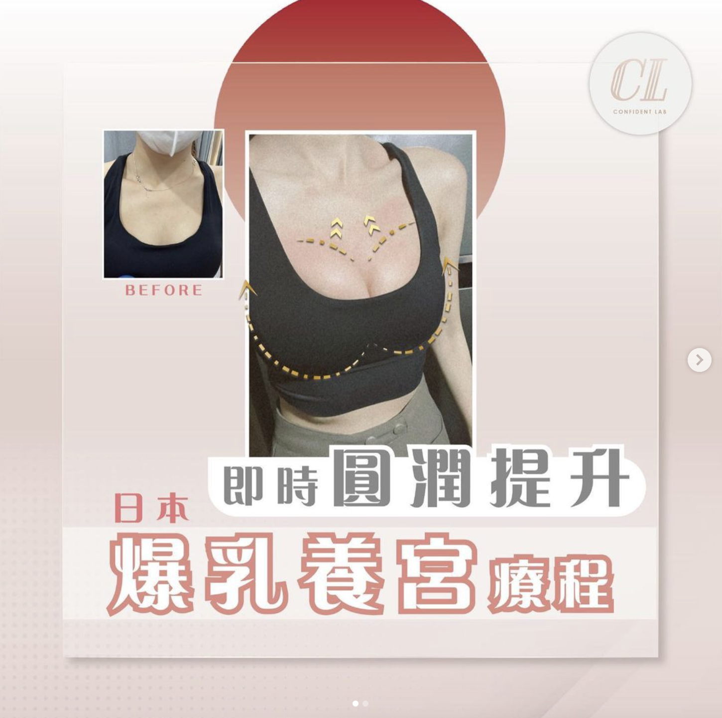 CL首創豐胸x養宮雙療程
