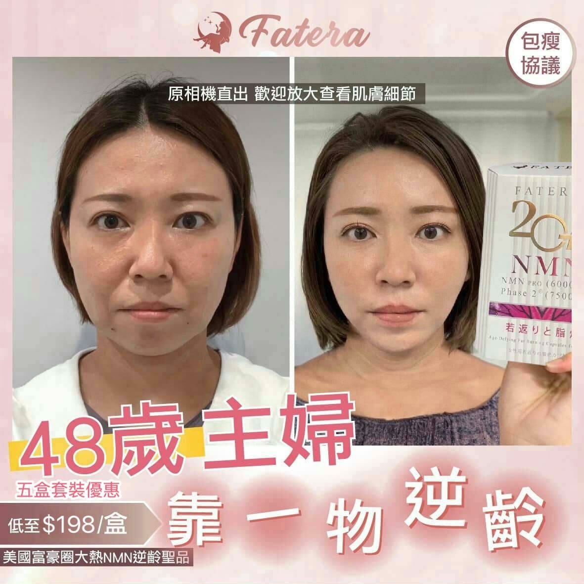 台灣超熱賣逆齡Fatera 20+ NMN｜一盒30粒裝｜逆齡｜燃脂｜美白｜預計一星期到貨