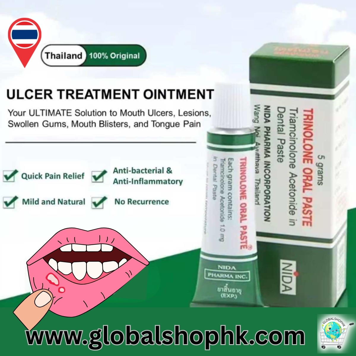 NIDA Trinolone Oral Ulcer treatment Oinment Paste, 5g