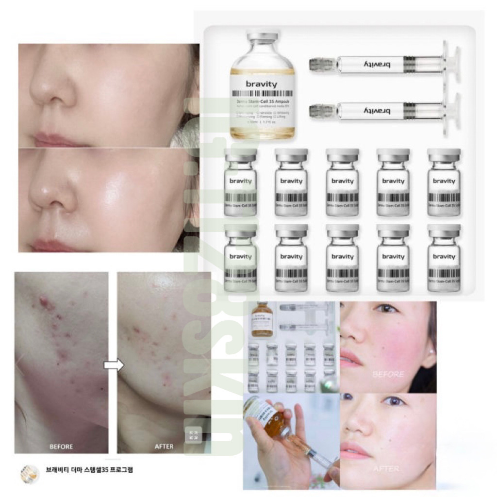 韓國 Bravity DERMA STEM CELL 35 PROGRAM 羊膜水幹細胞35修護套盒