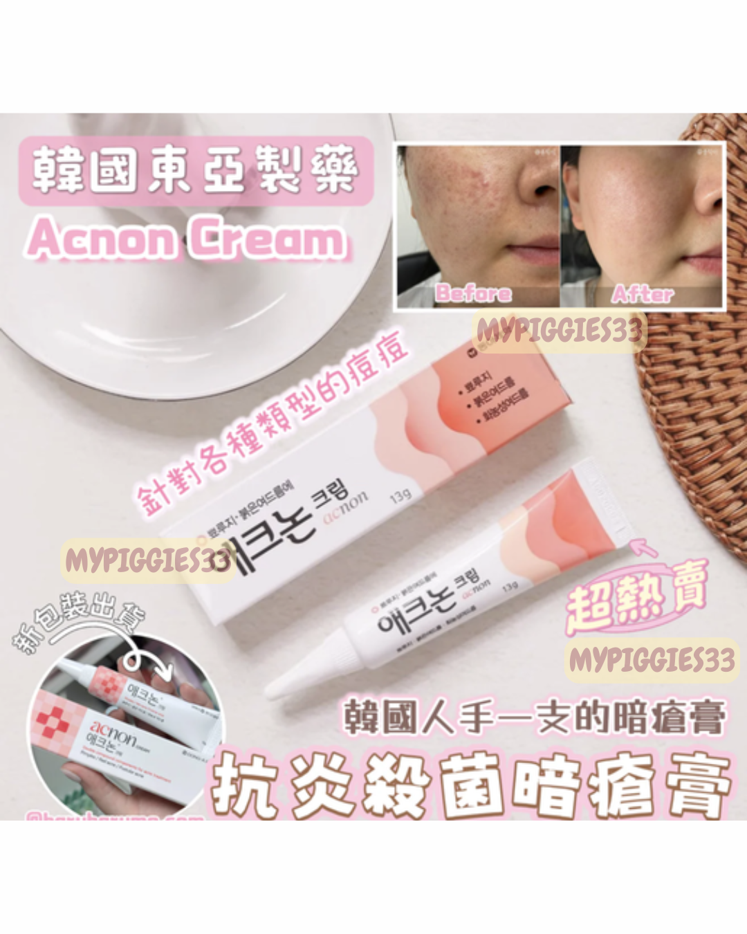 韓國東亞製藥消炎殺菌暗瘡膏 Acnon Cream (最新升級版)｜13g｜韓國藥房熱賣